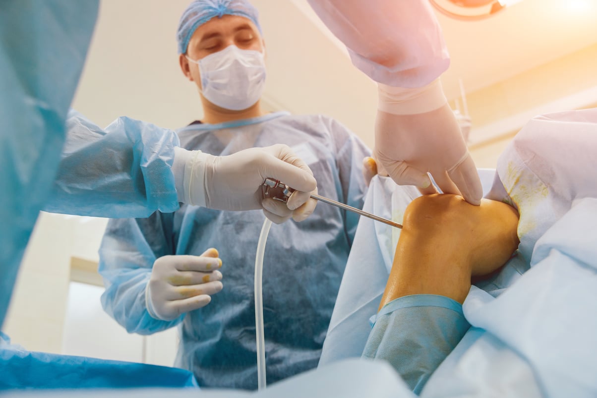 How Long Does ACL Surgery Take?