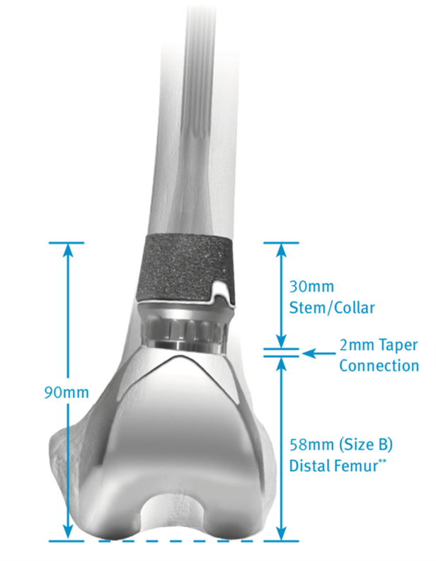 Megaprosthesis Total Knee Replacement For Periprosthetic Fracture