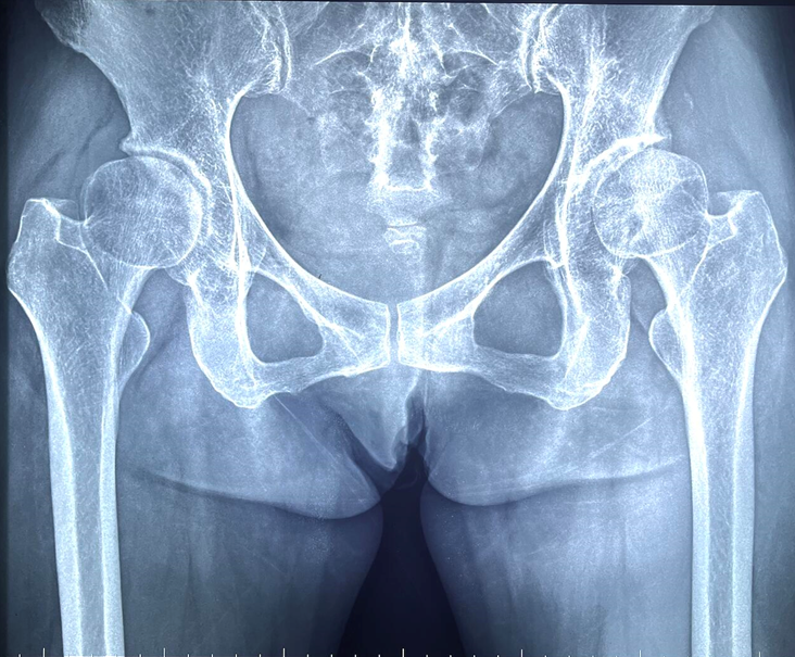 Hip Labral Tears | Orion Orthopaedic