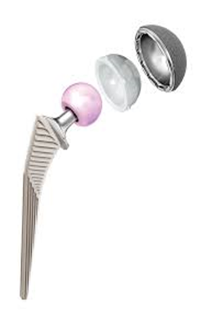 Long-Term Outcomes of Hip Replacement Surgery